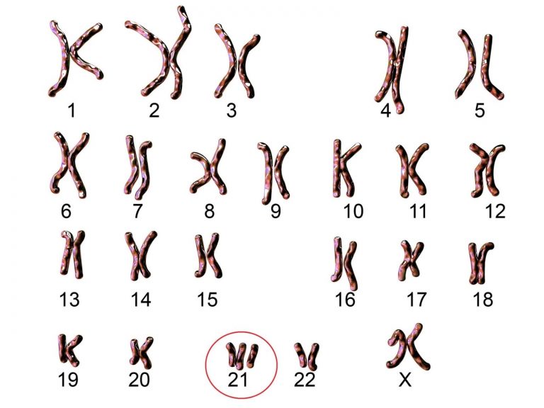 Diagnosis – Down Syndrome International